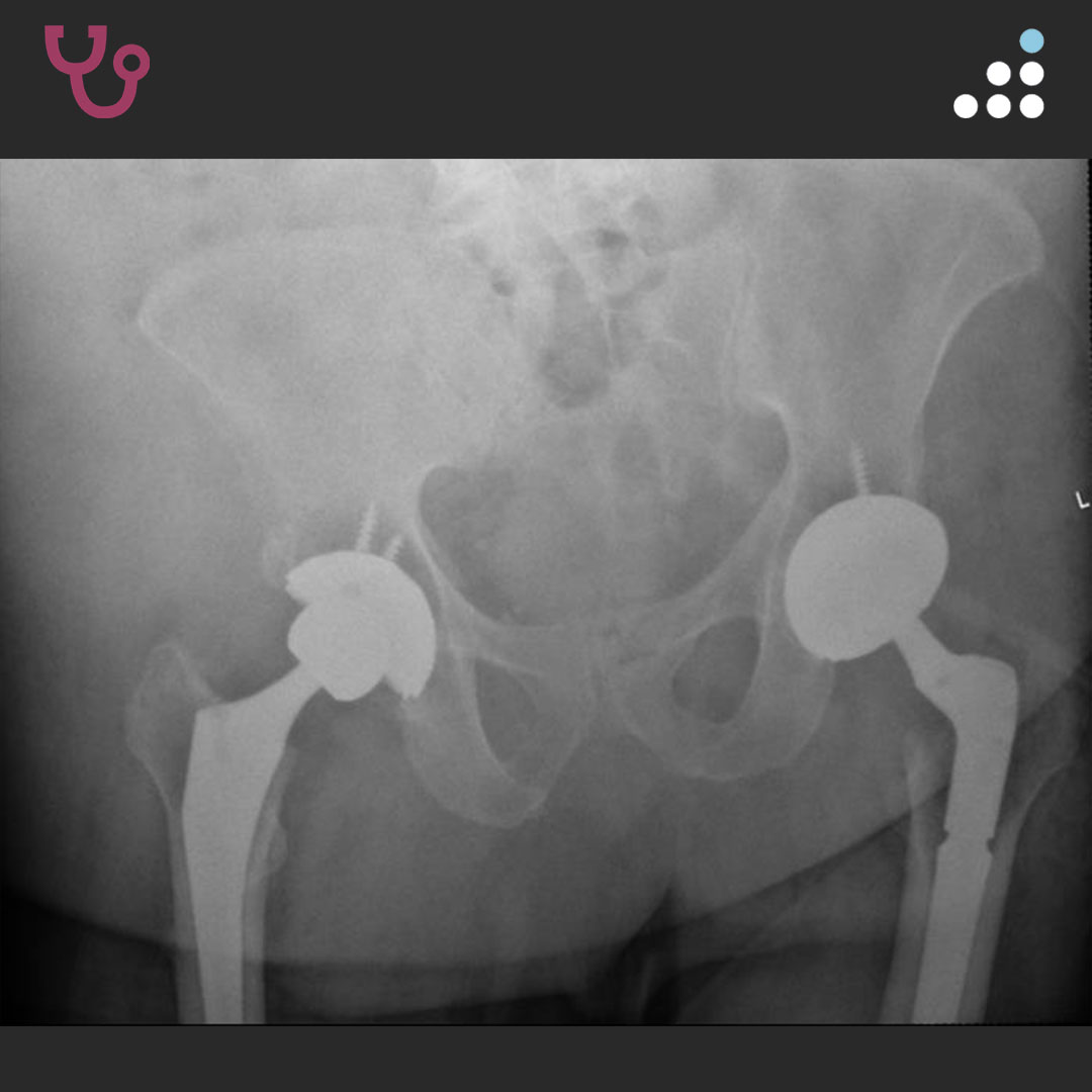 Mibsa Indo British Heritage Cup 2021 | British High Commission, New