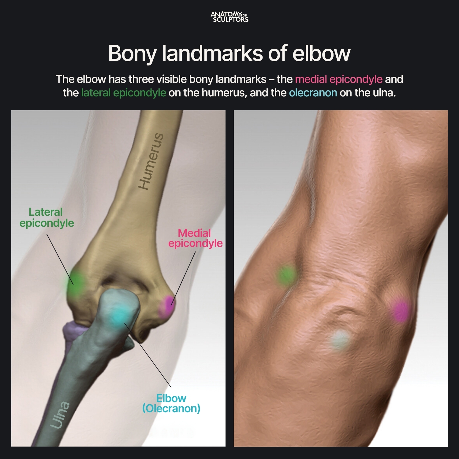 Lateral Epicondyle Anatomy