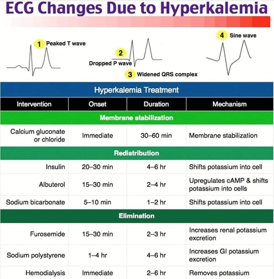 Hyperkalemia Levels And Ecg Changes Cardiac