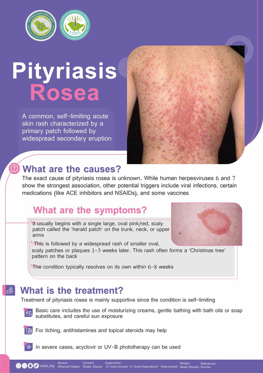 Pityriasis Rosea Christmas Tree »yuletide Archive: Scientific Advice