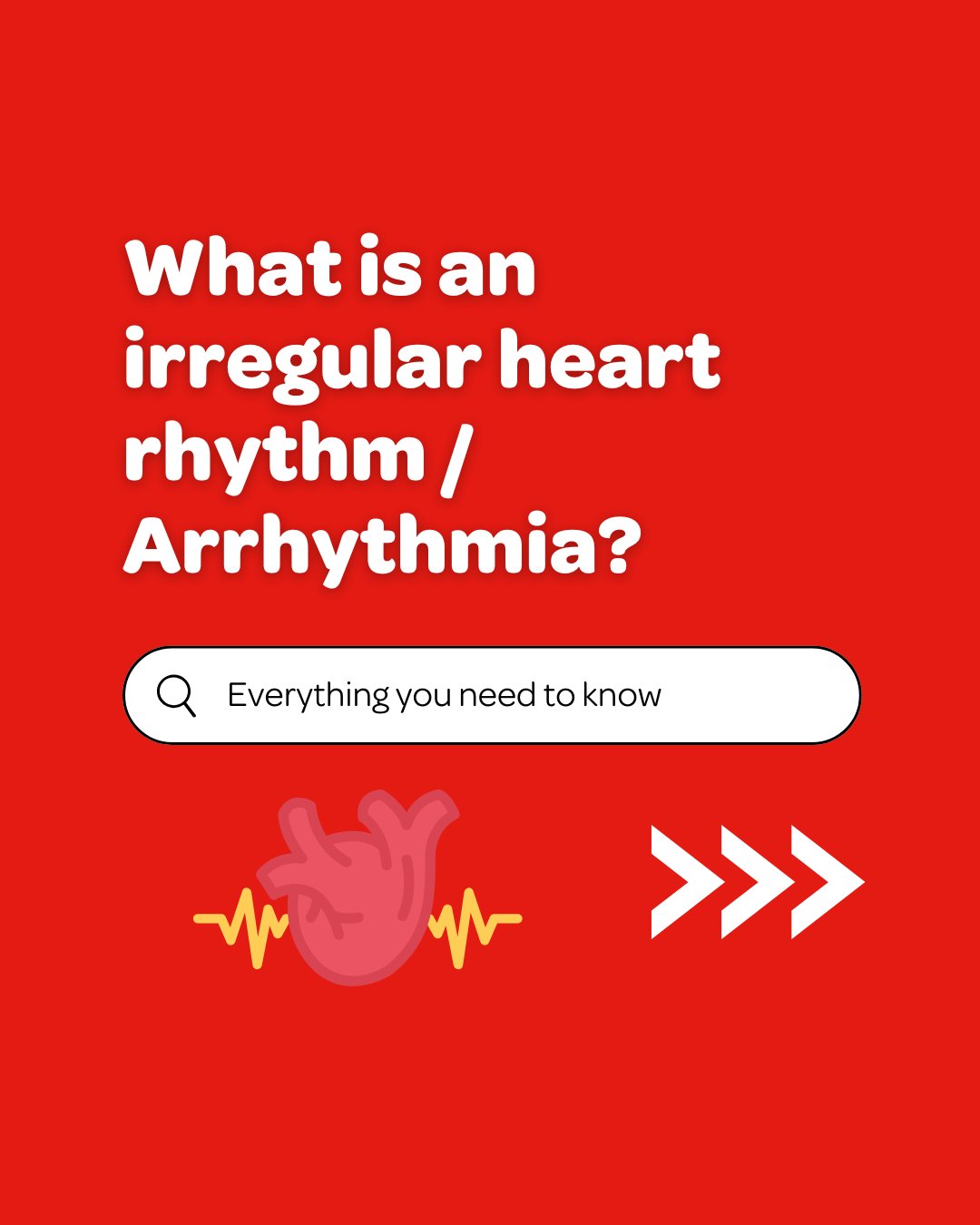 Heart Rate Irregular Rhythm Irregular Rhythms — Maimonides Emergency