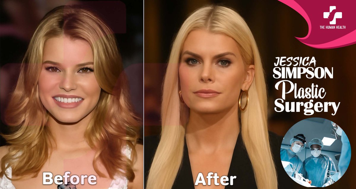 Jessica Simpson Plastic Surgery