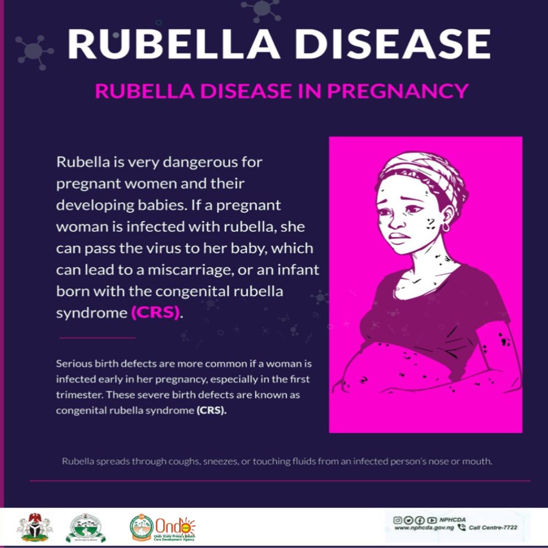 Congenital Rubella Syndrome Treatment