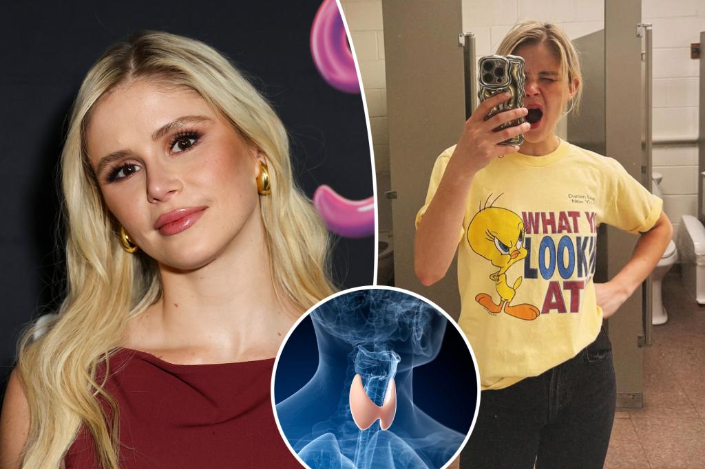 ‘The Boys’ Actor Erin Moriarty Announces Graves’ Disease Diagnosis and ...