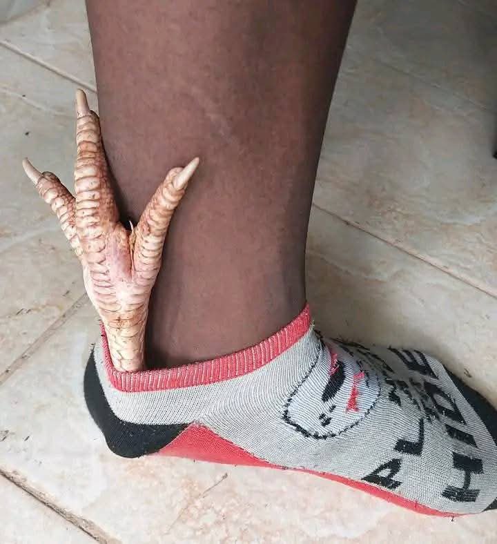 Chicken Legs Meme