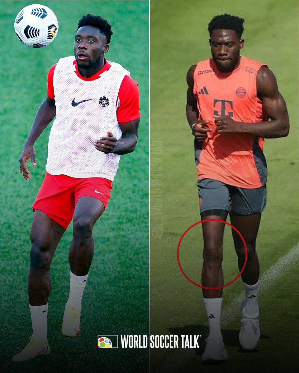 Thread By @worldsoccertalk - Alphonso Davies’ knee still...