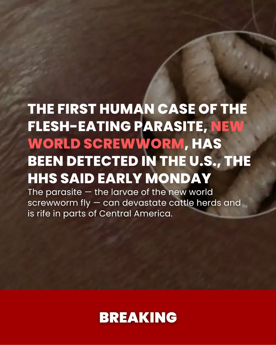 U.S. Confirms First Human Case of Flesh-Eating Screwworm Parasite ...