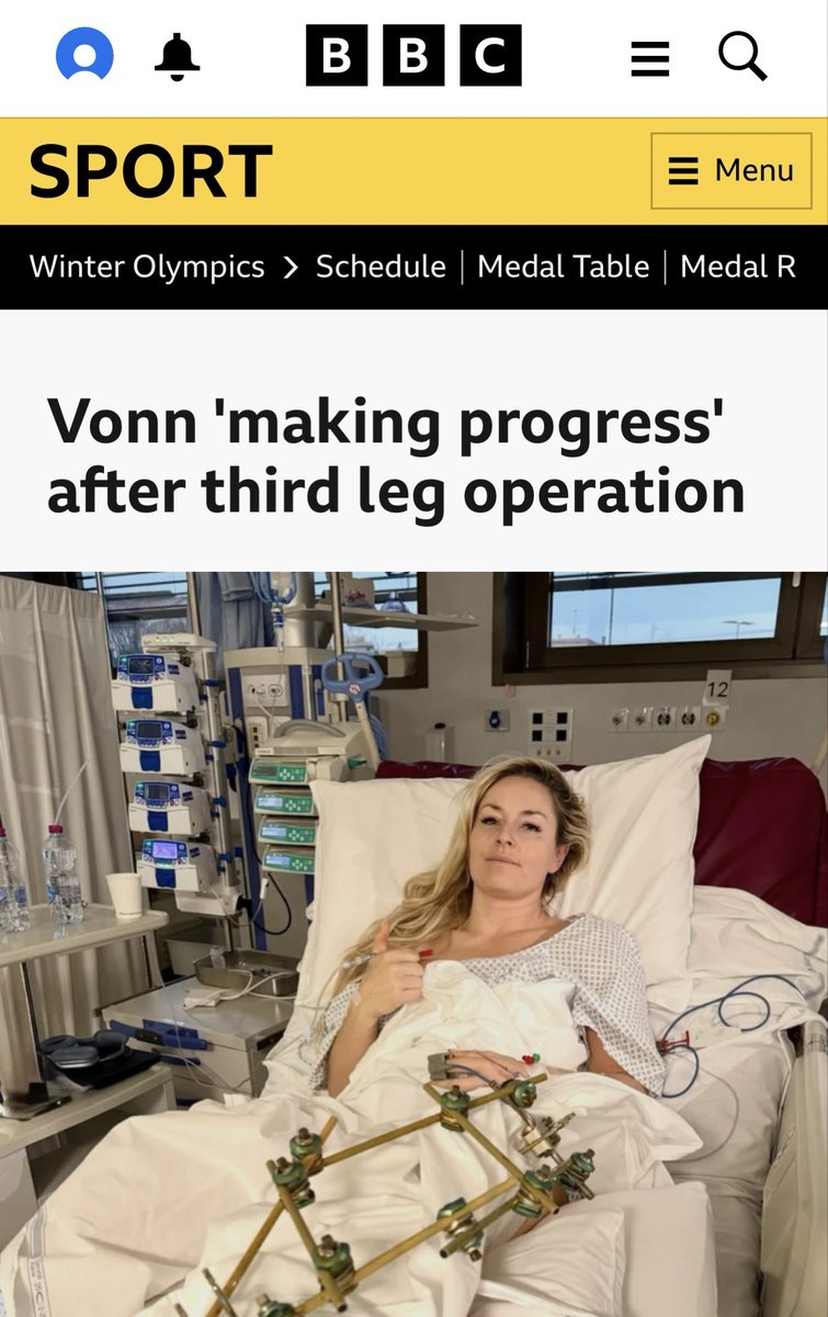 She has a third leg?!
