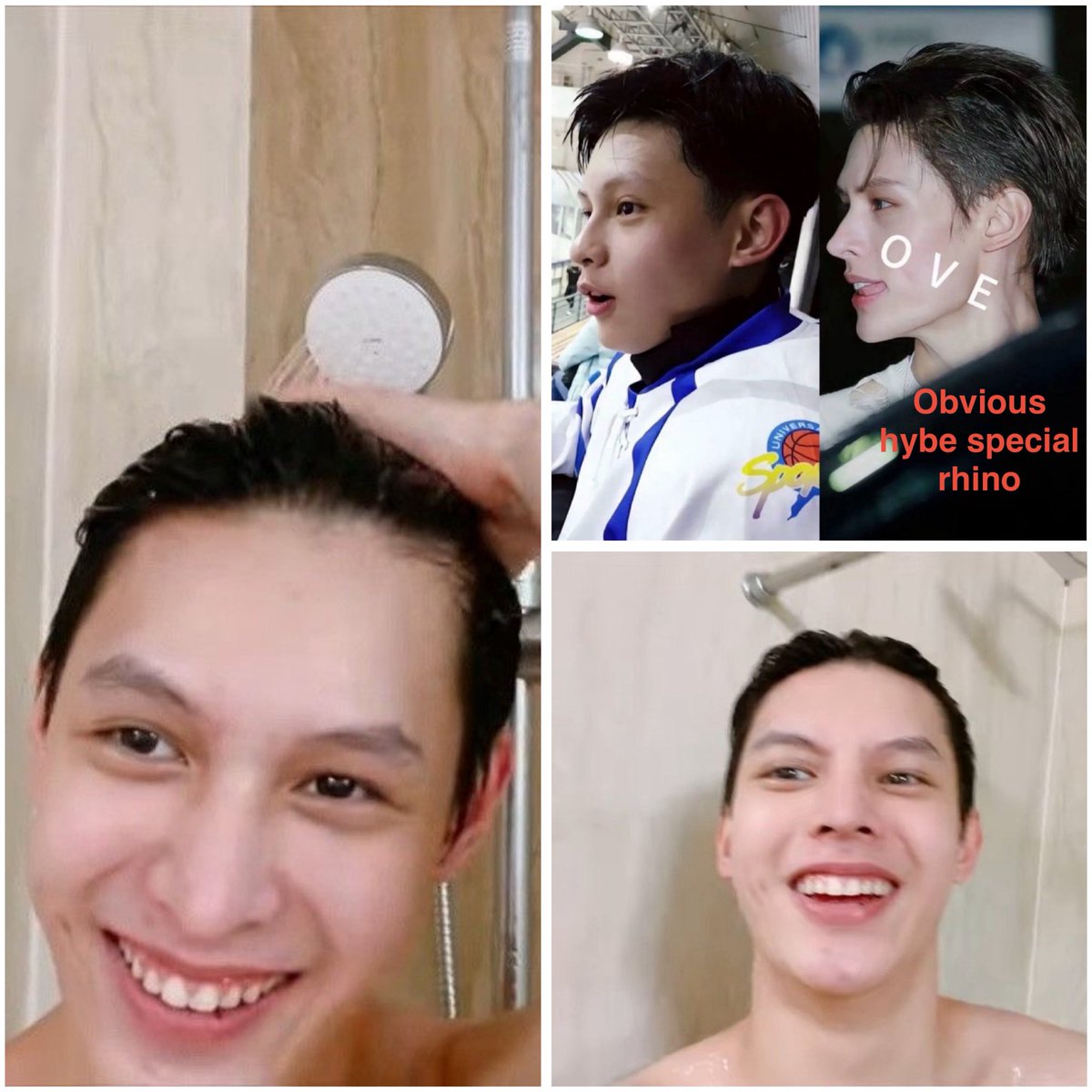 First James, he’s already gone viral for that hybe special rhinoplasty ...