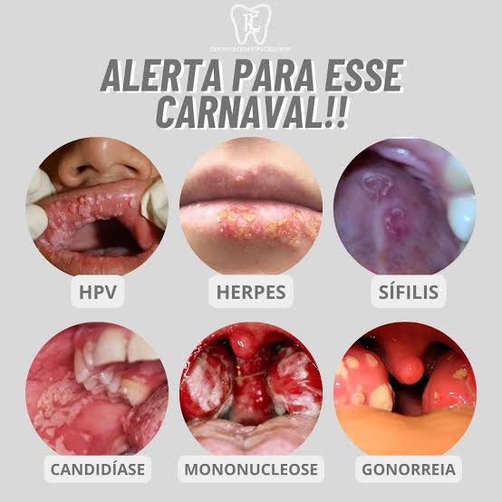 Conde Chocula o Vampiro forquilha. (@cartmanpeixe) / Posts / X