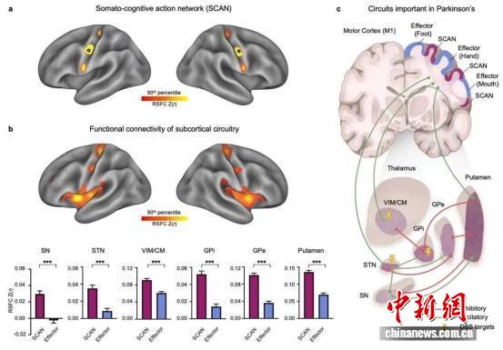 A study led by Professor Liu Hesheng’s team at Changping Laboratory ...