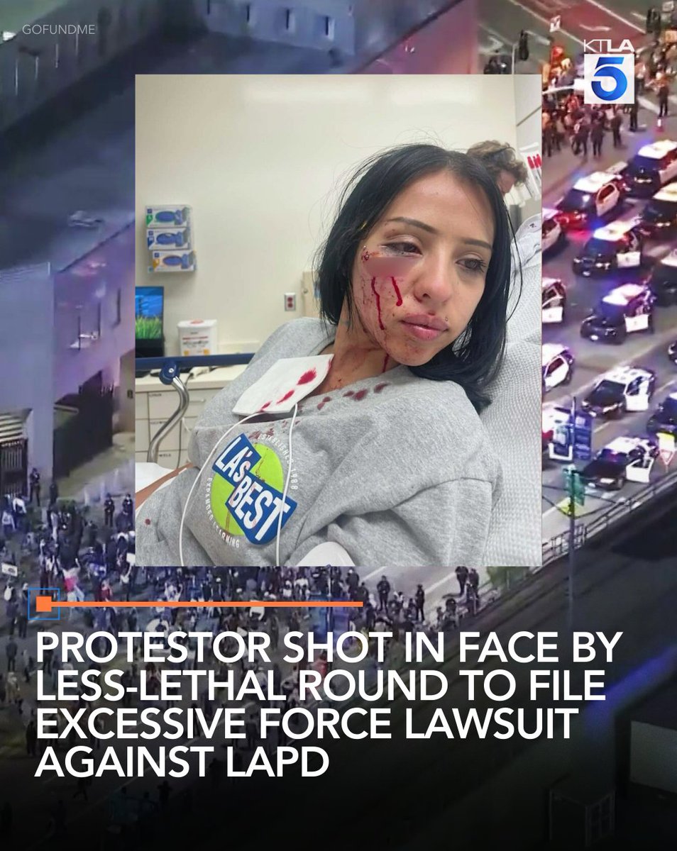 A woman who was shot in the face with a less-than-lethal round by a ...