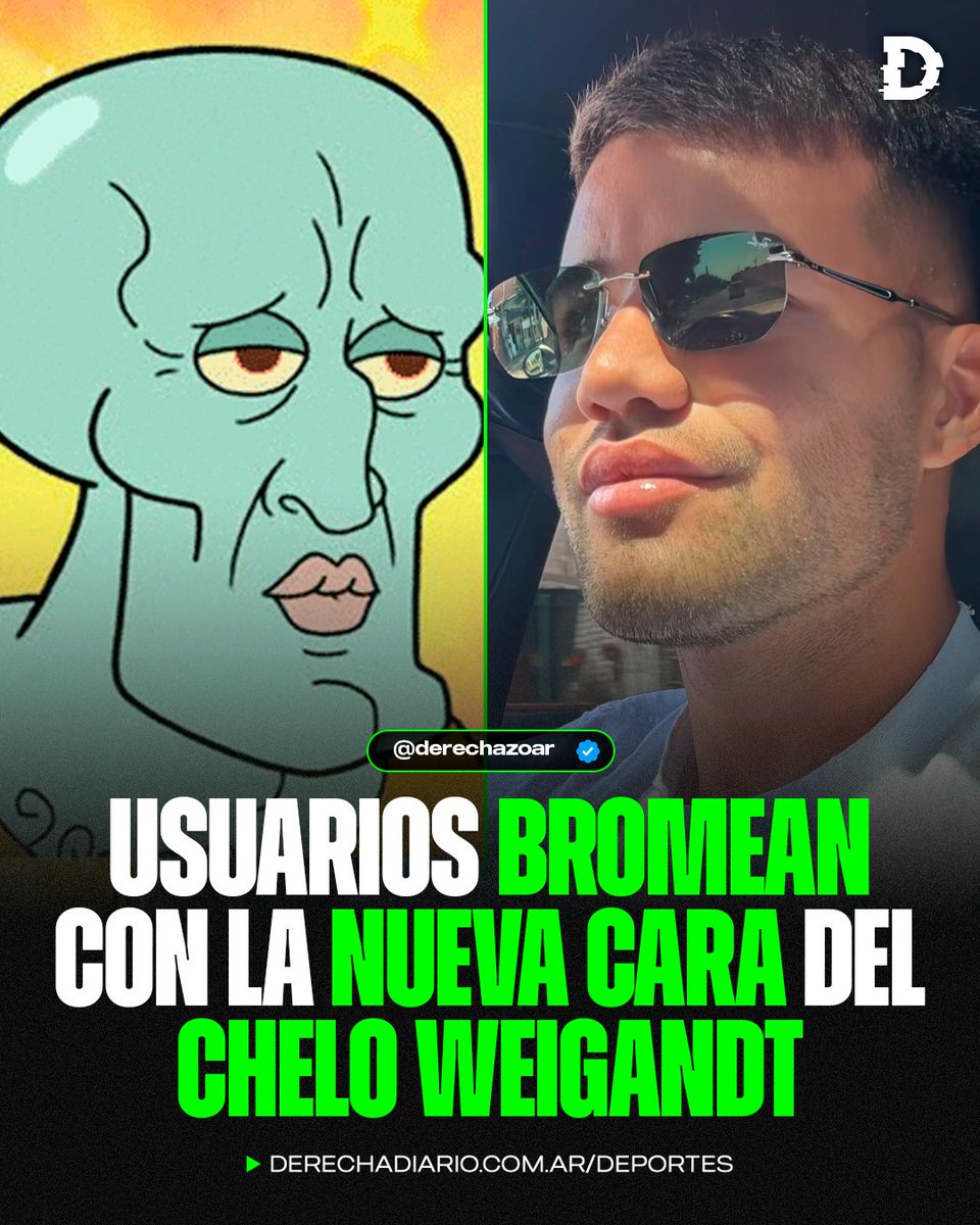 🇦🇷🏳️‍🌈🚨 ES IGUAL A CALAMARDO: Usuarios bromean con el nuevo aspecto del ...