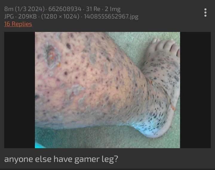 “Gaming” CEO’s should have Gamer Leg and less than 10 years left to ...