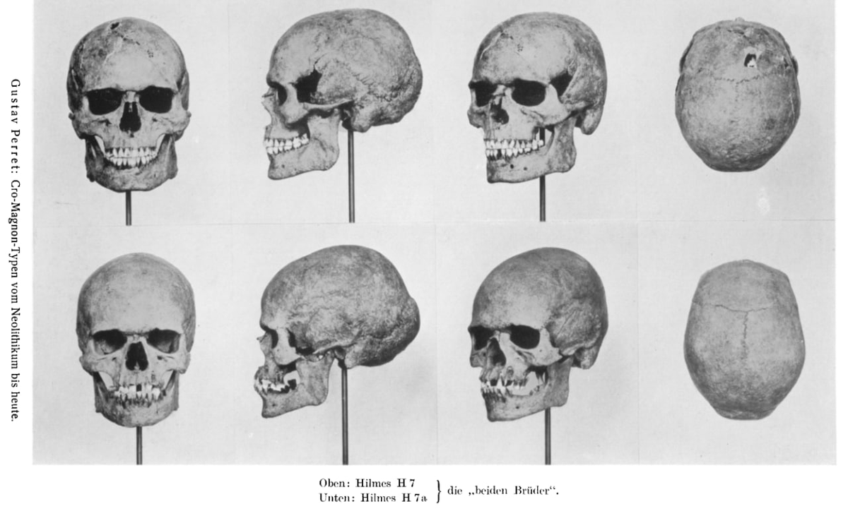 The skull of the reconstructed man and that of his prognathic ...