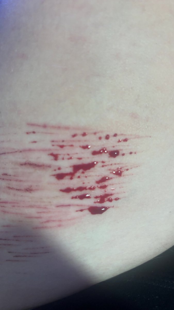 So what did the cut in the video look like to you bc I’m still thinking ...