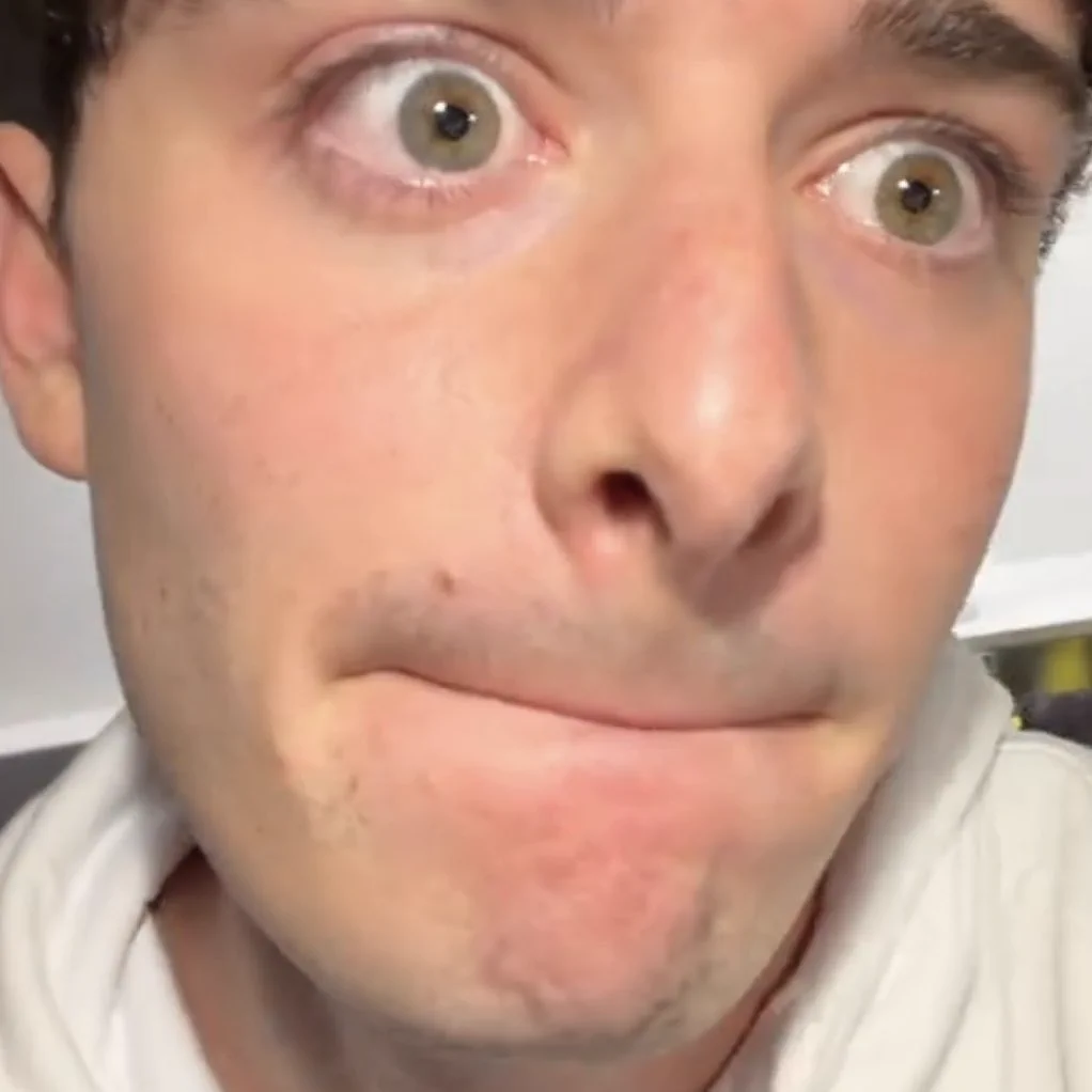 ⋆˚࿔ Ami 𝜗𝜚˚⋆ On X His Pretty Eyes Ugh I Adore Him Sm🫠 X