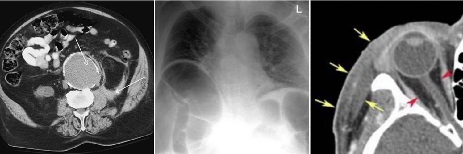 Radrounds Radiology Network Radrounds Twitter