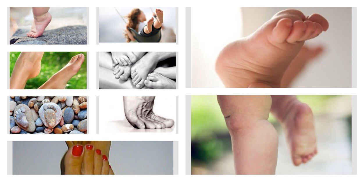 Feet First Podiatry (@feetfirstdpm) / Posts / X