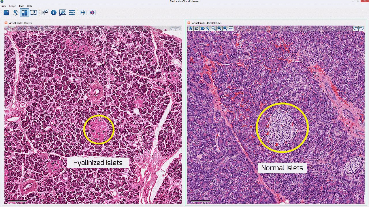 Pancreas Slide Islet Of Langerhans