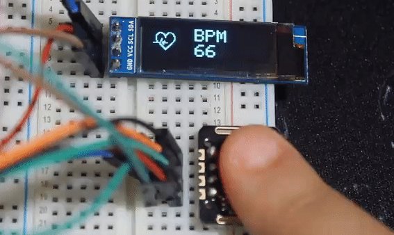 52 best Spo2 images on Pholder | Ouraring, Fitbit and EK Gs