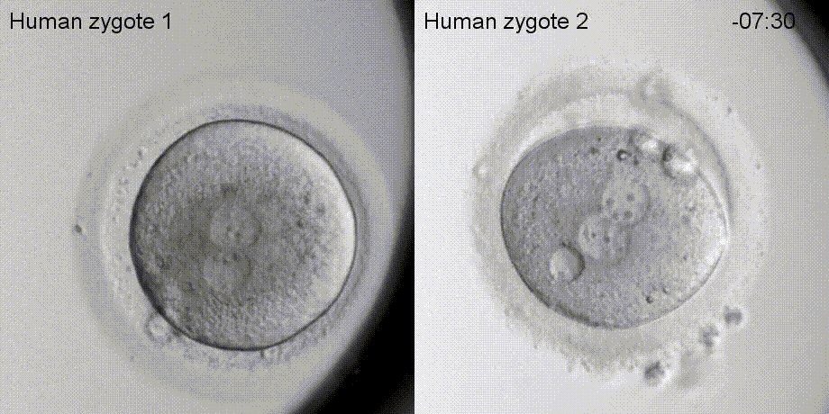 Zygote Embryo